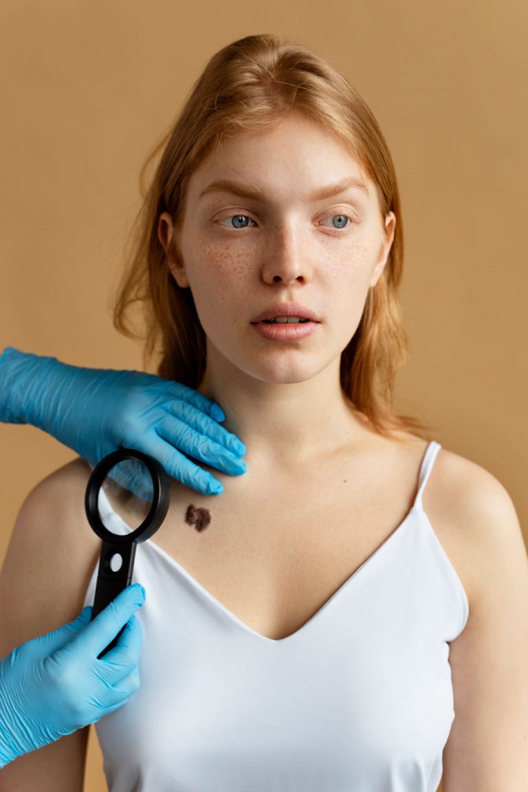 Early Detection of Basal Cell Carcinoma (BCC) and Squamous Cell ...